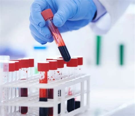 Professional Credential Verification Screeningchimp