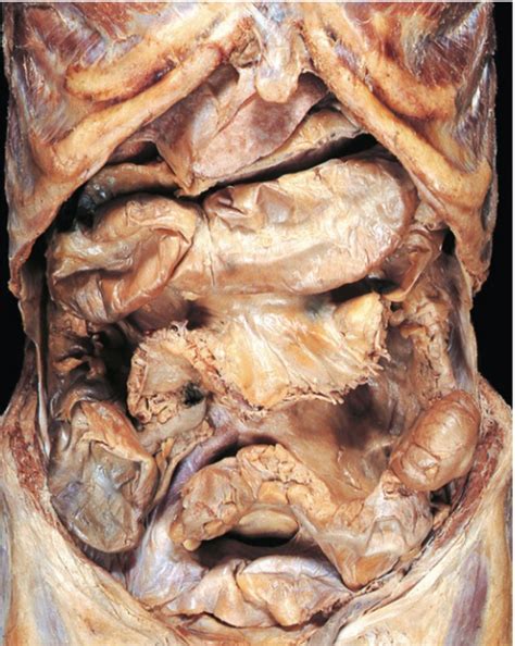 Large Intestine Dissection Diagram Quizlet