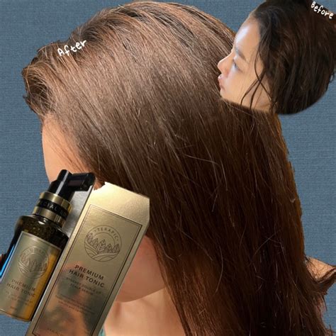 두피보호제 세럼 테라픽 헤어토닉 두피진정 케어 네이버 블로그