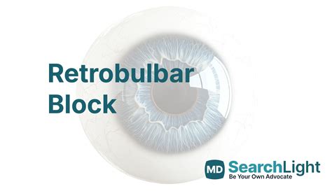 Retrobulbar Block Md Searchlight