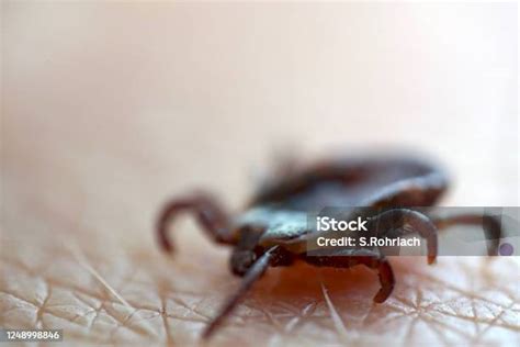 인간의 피부에 기어 다니는 기생 성 피부 의 매크로 클로즈업 화려한 암소 진드기 화려한 개 진드기 초원 진드기 및 습지 진드기로도 알려져 있습니다 0명에 대한 스톡 사진 및