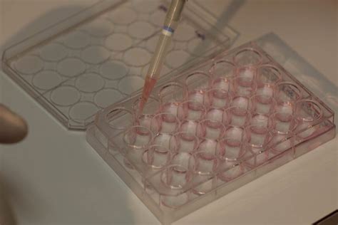 Ingegneria Genetica Pro E Contro Dell Alterazione Del Dna