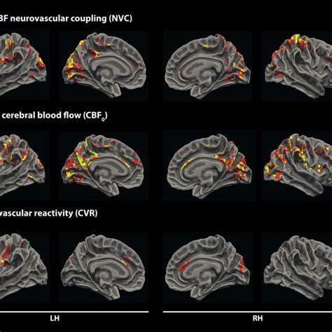 Voxelwise Differences Between Groups In Hemodynamic Markers Within The
