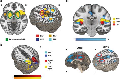 Activation And Deactivation Patterns During Horizontal Look Okn A