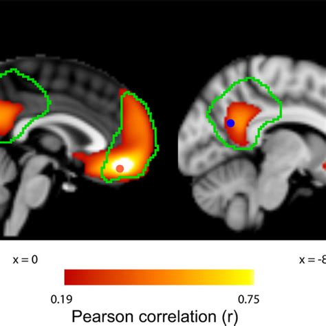 Functional Connectivity Between VmPFC And VPC And Overlap With Default Download Scientific