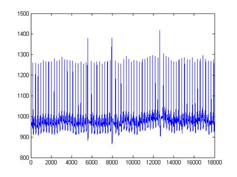 Detection Of Qrs Complexes In Ecg Signals Based On Empirical Mode