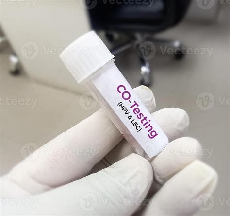 Vaginal Fluid Sample For CO Testing Or HPV DNA Test And LBC Test Human Papilloma Virus