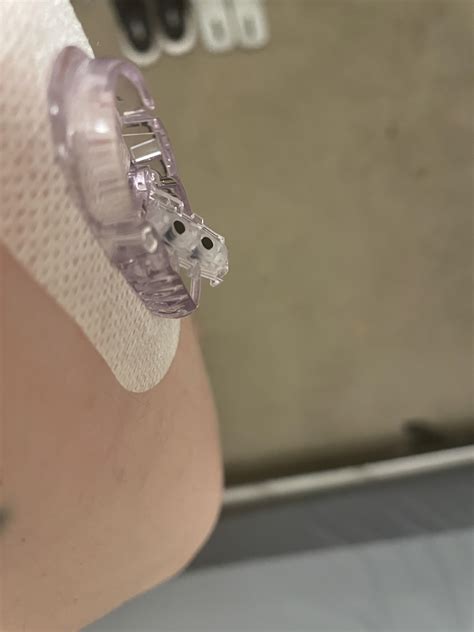 Still New To Dexcom Is This Still Useable Or Should I Replace The Sensor This Happened After I