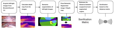 Distance Sonification For Laparoscopic Cholecystectomy Using Dense