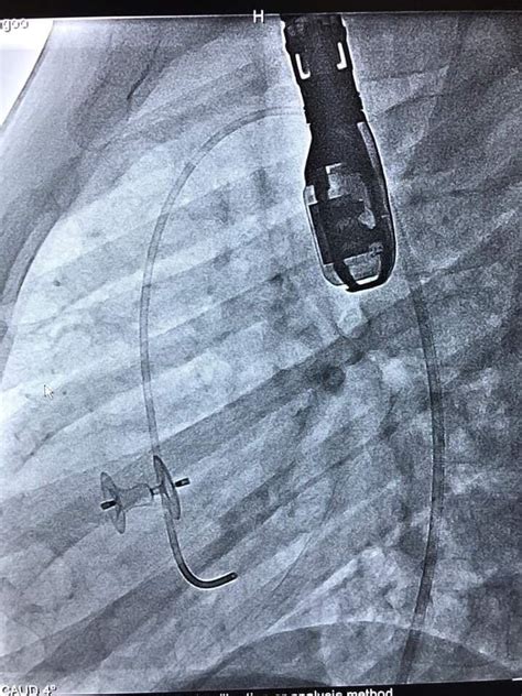 ЭХЭМҮТ ИЙН ЭМЧ НАР АНХ УДАА СУДСАН ДОТУУРХ МЭС ЗАСЛЫГ АМЖИЛТТАЙ ХИЙЛЭЭ