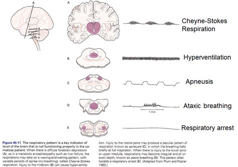 Usmle Step 1 Notes