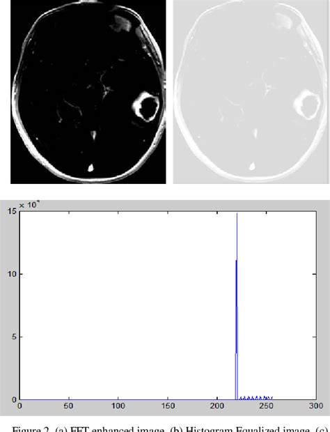 Figure 2 From To Detect Abnormality In Lung Images Using Watershed