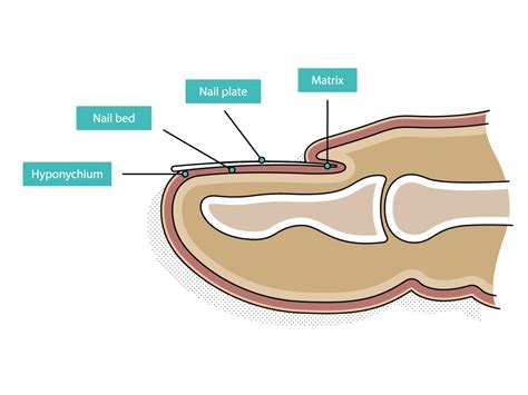 Common Nail Conditions Diagnosis And Treatment Options