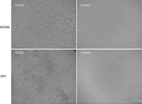 Microscopic Observation Of Cytopathic Effect On Mdbk Cells And Bpc