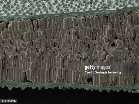 Environmental Scanning Electron Micrograph Photos And Premium High Res Pictures Getty Images