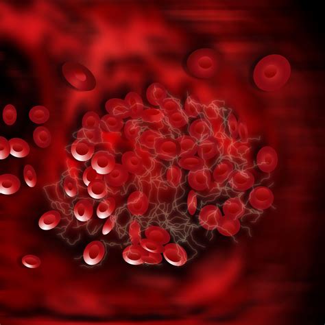 Pradaxa Bleeding Risks Lead To Patient Death And Other Dangerous Side Effects