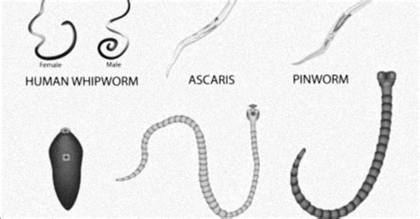 Whipworms In Humans
