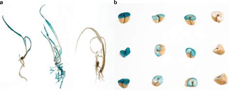 An Efficient And Reproducible Agrobacterium Mediated Transformation