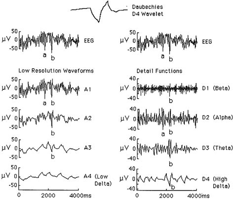 Four Level Dwt Of The Eeg Trace At The Top Of The Figure Using The