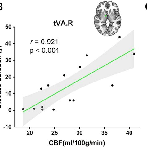 diagram of cerebral perfusion by multi delay asl mr imaging a the