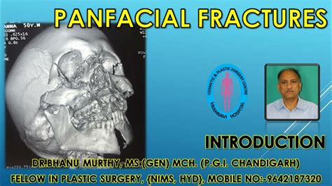 Panfacial Fractures Drm Bhanumurthy Vaishnavi Super Speciality Hospital Youtube