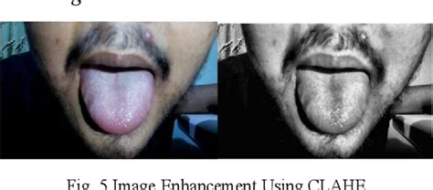 Figure 5 From Tongue Biometrics Extraction Based On Yolo Algorithm And Cnn Inception Semantic