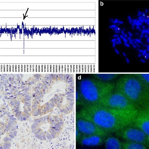 Tp53 Gene Copy Number Mutation And P53 Expression Sequence Analysis Download Scientific