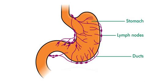 Lymph Nodes In Stomach Area