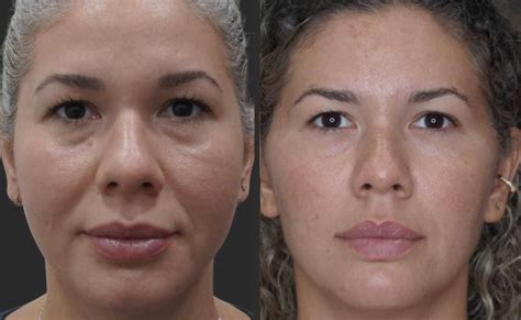 Top Manufacturer Supplies High Quality Pcl Cog Threads