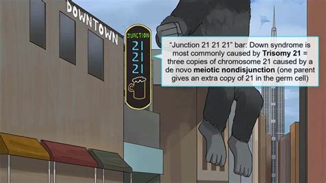 Chromosomal Syndromes 1 Trisomy 21 Soap Free Sketchy Medical Lesson