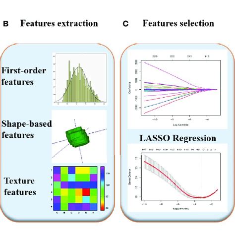 Radiomics Workflow Of Model Construction A Mr Images Segmentation