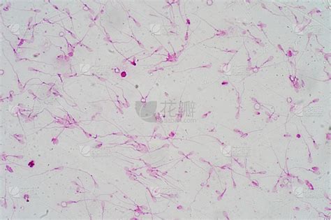 显微镜下的人类精子形态。显微照片显示精子
