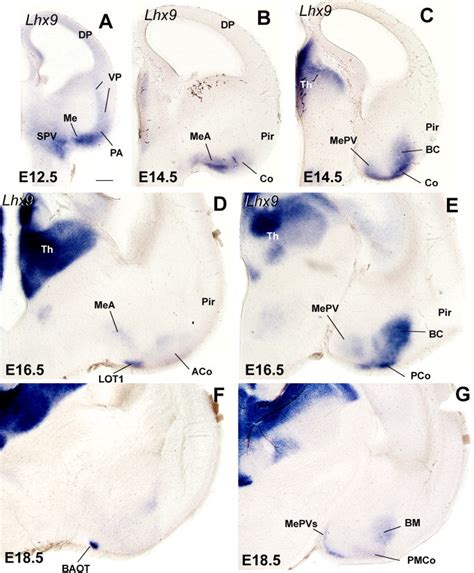Frontal Sections Through The Embryonic Telencephalon Of Four Different