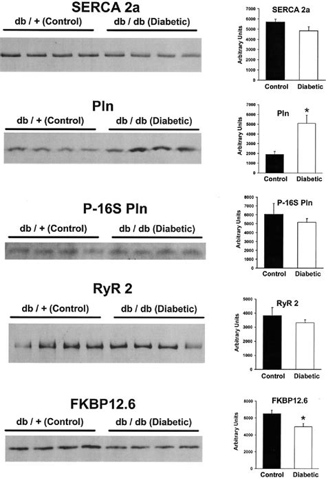 figure 5 from decreased sarcoplasmic reticulum activity and