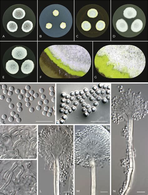 Macromorphology And Micromorphology Of Aspergillus Alboviridis A E Download Scientific