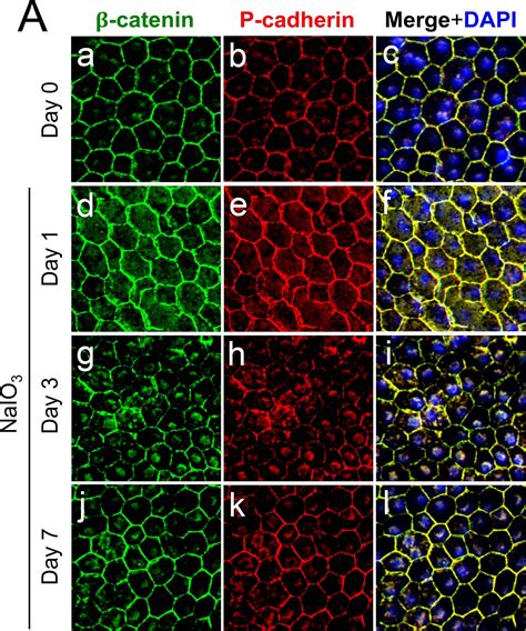 Beta Catenin Antibody Nbp1 32239 Bio Techne