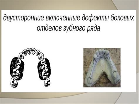 Частичная потеря зубов презентация онлайн