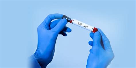 How Long Do STD Screening Results Take STD Screening