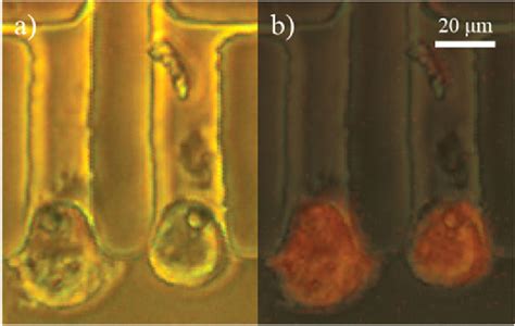 Figure 1 From A High Throughput Automated Microinjection System For Human Cells With Small Size