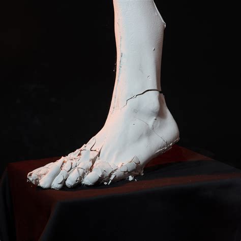 Phelim Hoey On How His Ms Diagnosis Became A Driving Force Of His Practice 1854 Photography