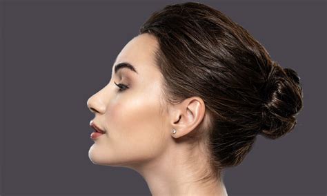 Masseter Botoks Doç Dr Özlem Köse İstanbul