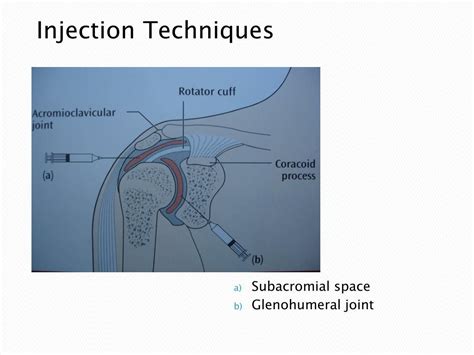 Ppt Common Shoulder Conditions In General Practice Powerpoint Presentation Id 4329818