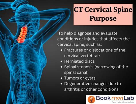 Ct Cervical Spine Scan Price Book Online At Top Radiology Centers