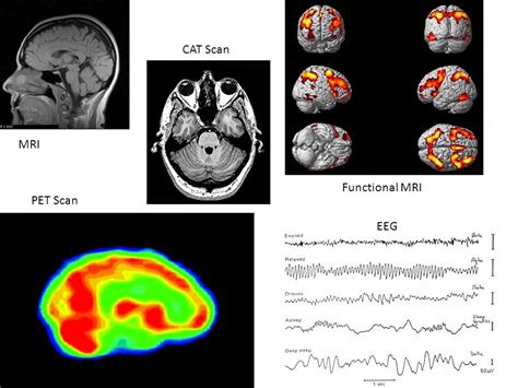 Eeg Brain Scan