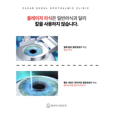라식수술 검사 올바른 방법을 통해 클리어서울안과건강해지는