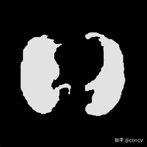 YOLOv 医学图像分割 知乎