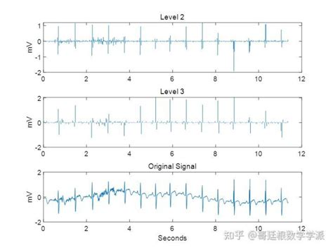 双树复小波变换dual Tree Complex Wavelet Transform在信号处理中的应用 哔哩哔哩