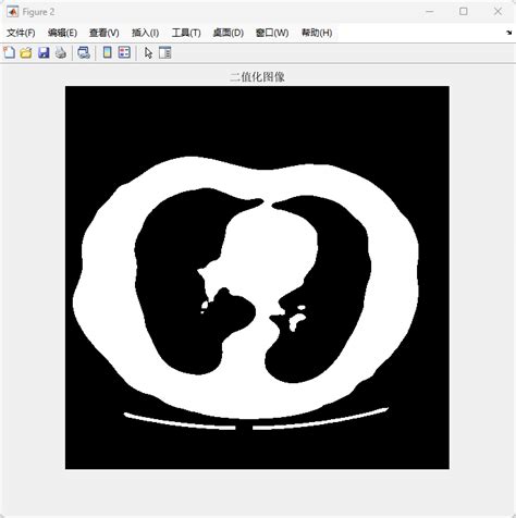 基于matlab分水岭算法的医学dicom图像肺结节检测与区域特性分析 csdn博客