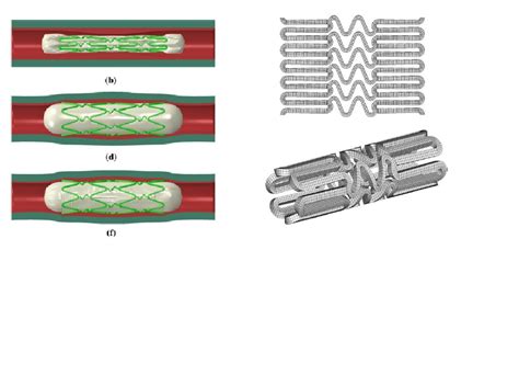 Utiliser MATLAB Sous Abaqus Simulation