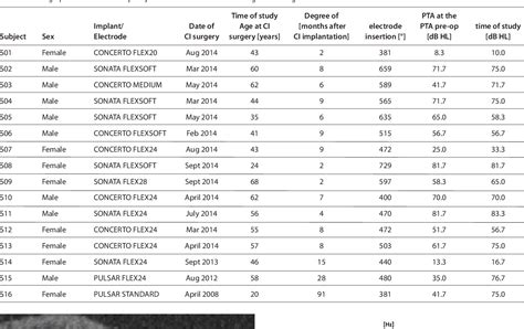 Table 1 From Cochlear Microphonics In Hearing Preservation Cochlear Implantees Semantic Scholar
